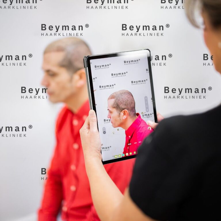 Beyman: Haarimplantatie door specialisten met jarenlange ervaring
